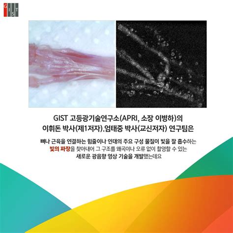 gist 광주과학기술원 [고등광기술연구소 이휘돈 ‧ 엄태중 박사 연구팀 힘줄만의 3차원 모습을 facebook
