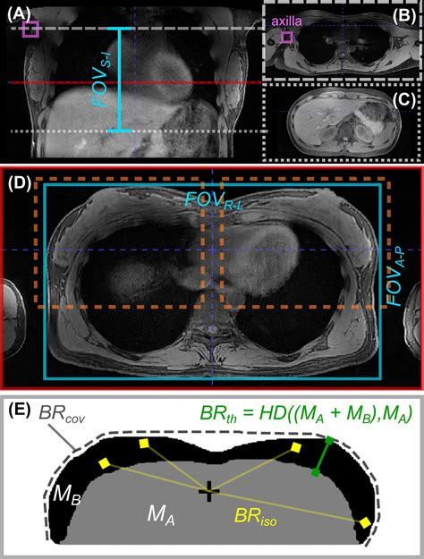 Characterizing The Imaging Environment For Supine Breast Mri