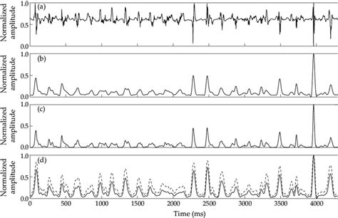 Comparative Analysis Of The Preprocessing Stage Of Each Of The Compared