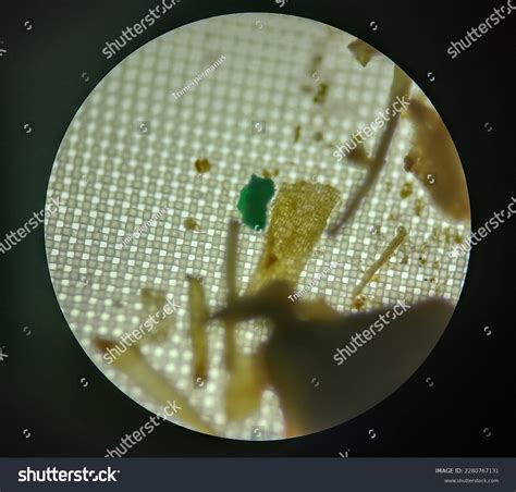 63 Resultados De Imágenes Fotos De Stock E Ilustraciones Libres De Regalías Para Microplastics