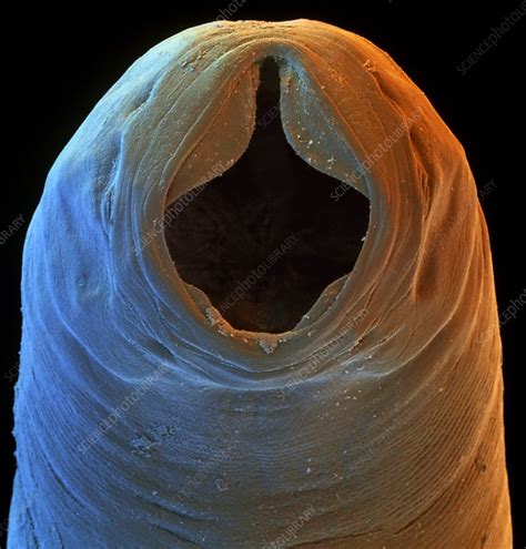Colour Sem Of The Head Of A Hookworm Necator Sp Stock Image Z180