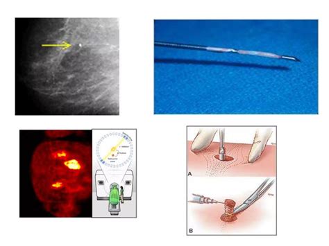Histological Techniques Section 1tissue Collection And Grossing Pptx