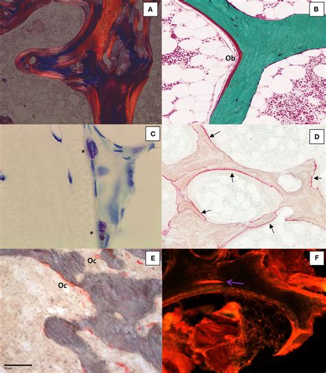 Frontiers Interest Of Bone Histomorphometry In Bone Pathophysiology Investigation Foundation