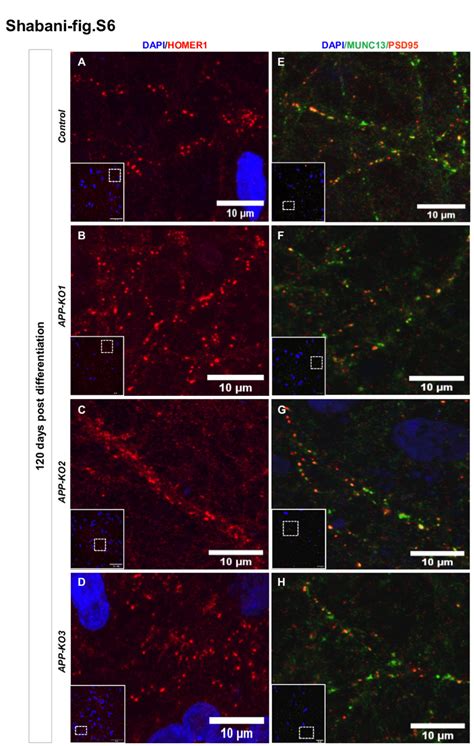 Fig S6 Pre And Post Synaptic Markers Are Expressed 120 Days Post