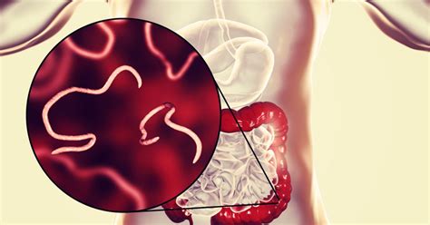 Kako Izgledaju Gliste U Stolici Kod Odraslih I Djece Trajanje I Liječenje Telegramhr