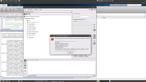 How To Import Other Brain Atlases To Use As Scouts Discussions Brainstorm