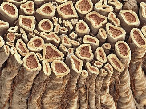 Spinal Root Nerves Sem Stock Image C006 5940 Science Photo Library