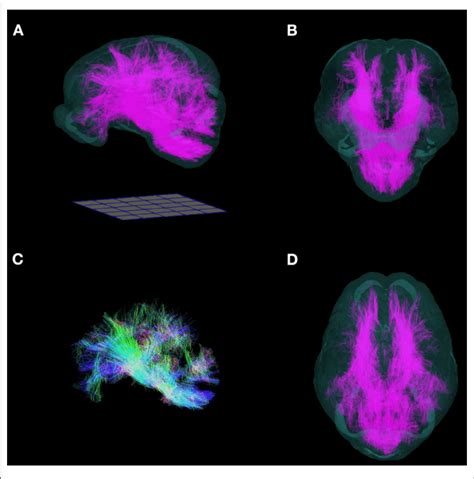 Three Dimensional Reconstruction Of Whole Brain Tractography In The Download Scientific