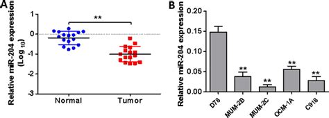 mir 204 expression markedly decreases within um cells and tissues a