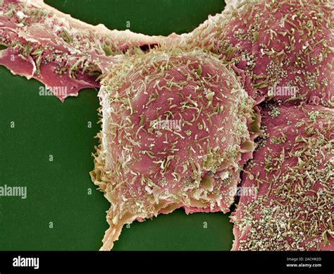 What Does Herpes Look Like Under Microscope At Dakota Davis Blog