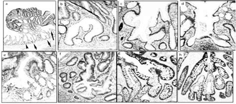 Figure 1 From Are Non Dysplastic Crypts With Corrupted Shapes The