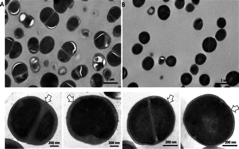 Characteristics Of Population Structure Antimicrobial Resistance