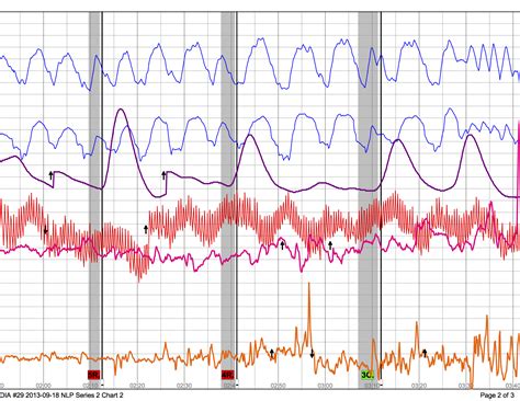 Leaked Documents Point To Dias Inability To Detect Sophisticated