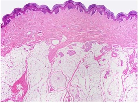 Anatomy Lab Integumentary Microscope Slides Flashcards Quizlet