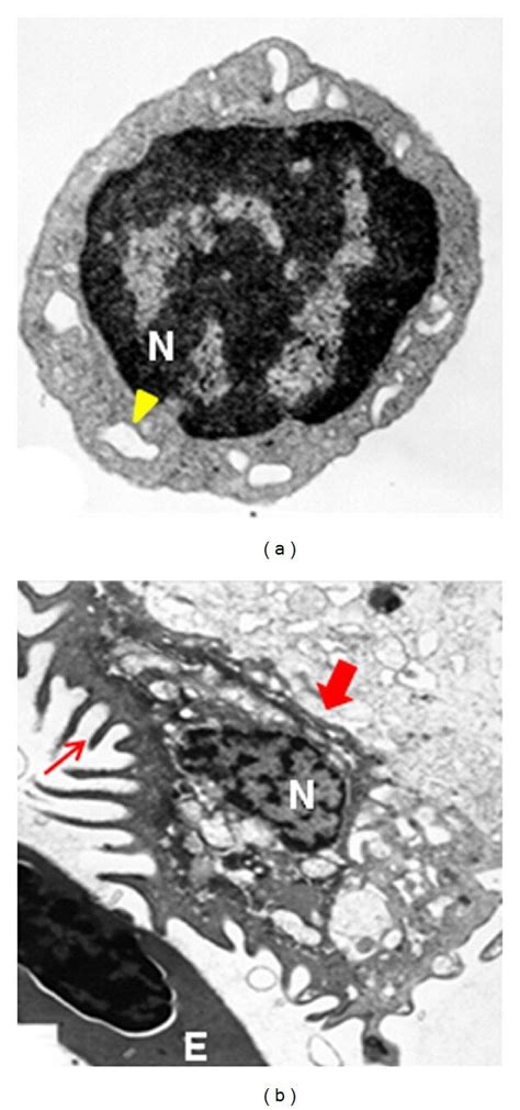Zebrafish Thrombocyte Electron Micrographs A Zebrafish Thrombocyte