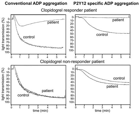 Representative Adp Aggregation Curves Demonstrating The Effect Of