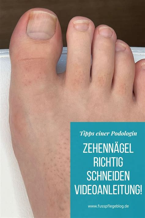 Fussnägel Schneiden So Geht Es Richtig Fußnägel Richtig Schneiden