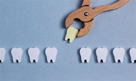 Oral Surgery For Tooth Extraction Dental Specialists Of Southern Colorado