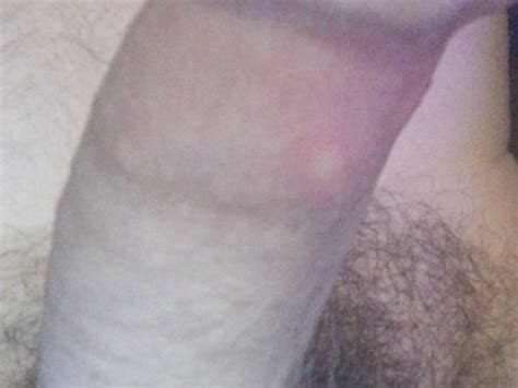 Knuckles Kanal Porn300com