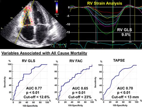 Comparison Of Right Ventricular Strain Analysis To Routine