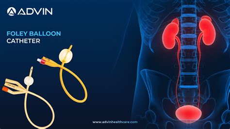 How To Use Balloon Catheter