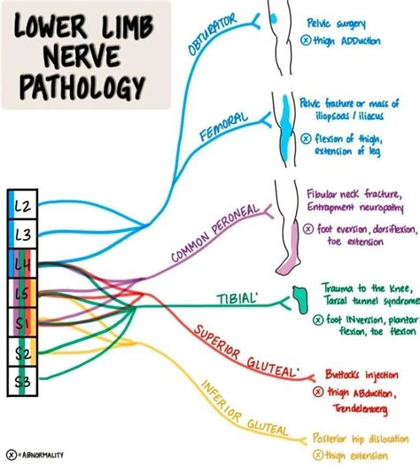 Why Is Bilateral Sciatica A Red Flag And How Is It Diagnosed Bilateral Sciatica Is A Red Flag