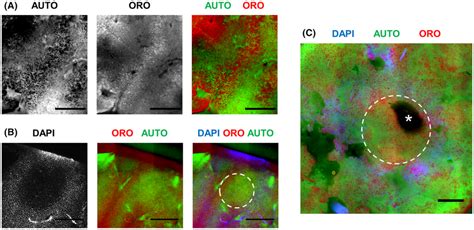 Whole Mount Fluorescent Staining And Microscopy Shows Features Of Obob Download Scientific