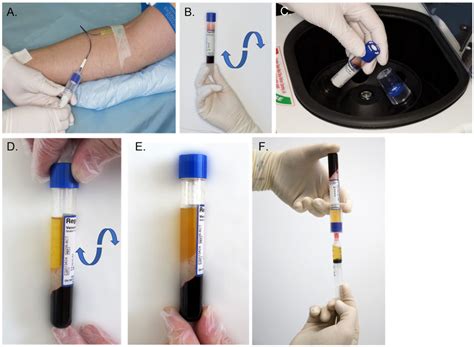 Process Of Standardized Prp Production Regen Prp Tubes Are Designed Download Scientific