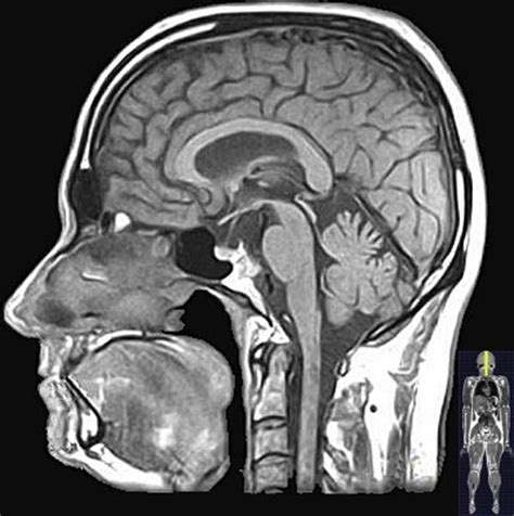Magnetic Resonance Imaging Mri Floyd Valley Healthcare