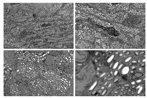 Field Emission Scanning Electron Microscope Fesem In Lizard Ski