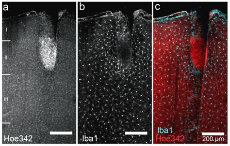 Chronic Intracortical Microelectrode Arrays Induce Non Uniform Depth