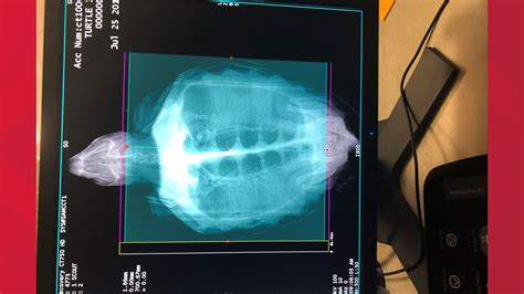 Sea Turtles Get Ct Scans Like Human Patients At Sentara Albemarle