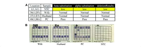 Routine Genetic Assays For 23 Types Of Variations In Hba And Hbb Genes Download Scientific
