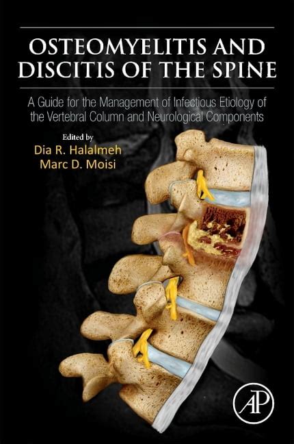 Osteomyelitis And Discitis Of The Spine A Guide For The Management Of Infectious Etiology Of