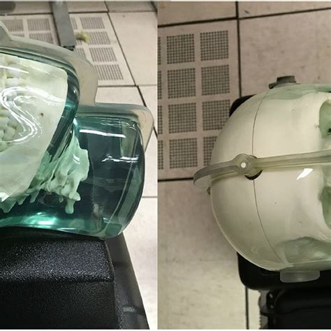 Cirs Head Phantom With Srs Frame And All Localizer Devices Download Scientific Diagram