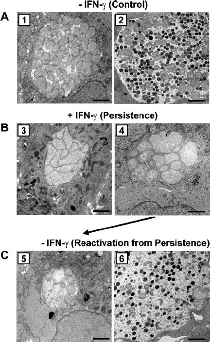 Transmission Electron Microscopy Of C Trachomatis Infected Cells