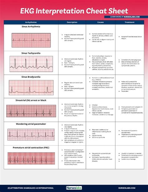 Ekg Interpretation Cheat Sheet Heart Arrhythmias Guide