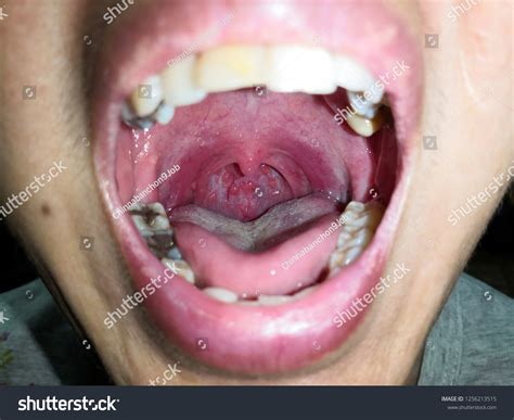 No While Oblong For Which Authorised Exploiter Score Shall Nay Surpass