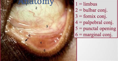 1 Conjunctiva Flashcards Quizlet