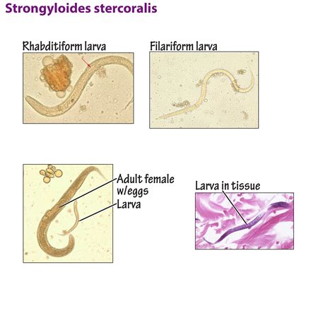Strongyloides Stercoralis Larvae Size