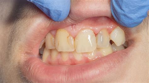 Colgate Oral Health Network