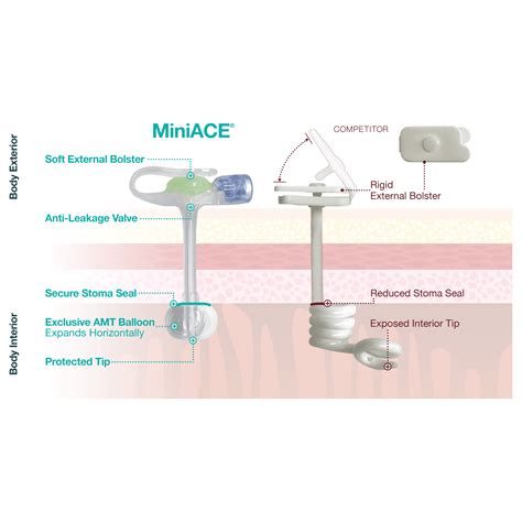 Amt Miniace® Irrigation Set 30cm Right Angle Irrigation Set Anjelstore