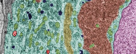 Explainer What Is The Endolysosomal Pathway Van Andel Institute