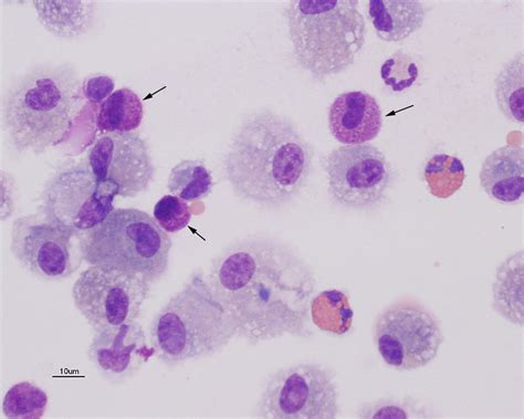 Bal Archives Eclinpath
