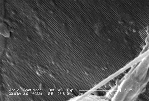 Free Picture Spiders Possess Exoskeleton Composed Chitin Molecule