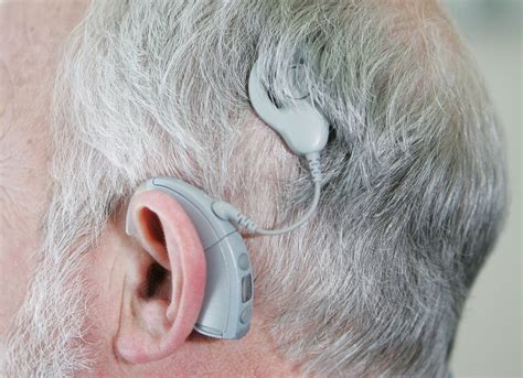 Cochlear Implants — Hearing Institute Tinnitus Specialists