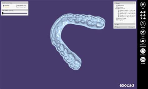New Digisplint Set To Revolutionise Splint Therapy Using Latest In Cadcam