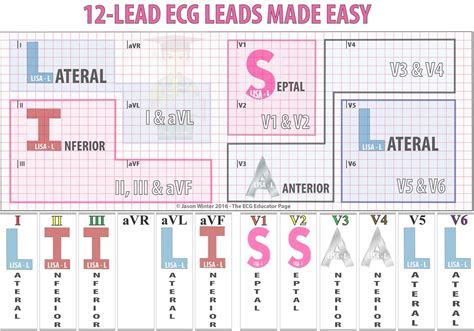 12 Lead Interpretation Chart Chartdevelopment