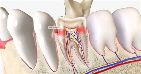 Sensitive Teeth Is A Common Dental Condition Characterized By Sharp