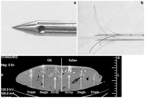 Comparison Of Three Different Needles For Percutaneous Injections Abstract Europe Pmc